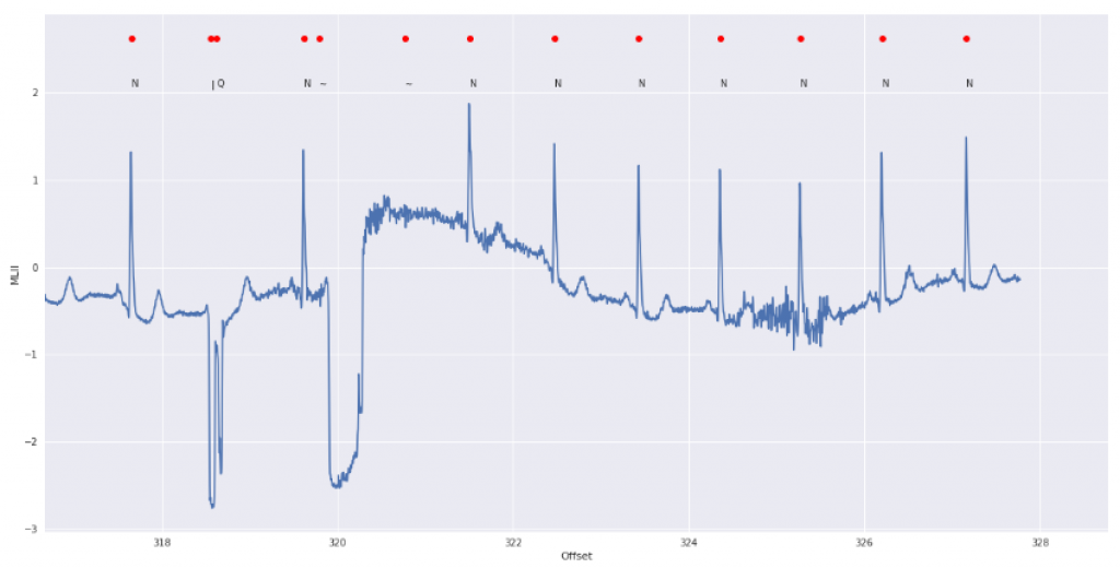 Machine Learning for ECG Classification – Koen Aerts